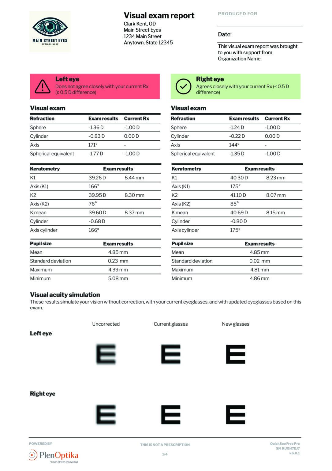 Handheld Autorefractor: QuickSee Free from PlenOptika