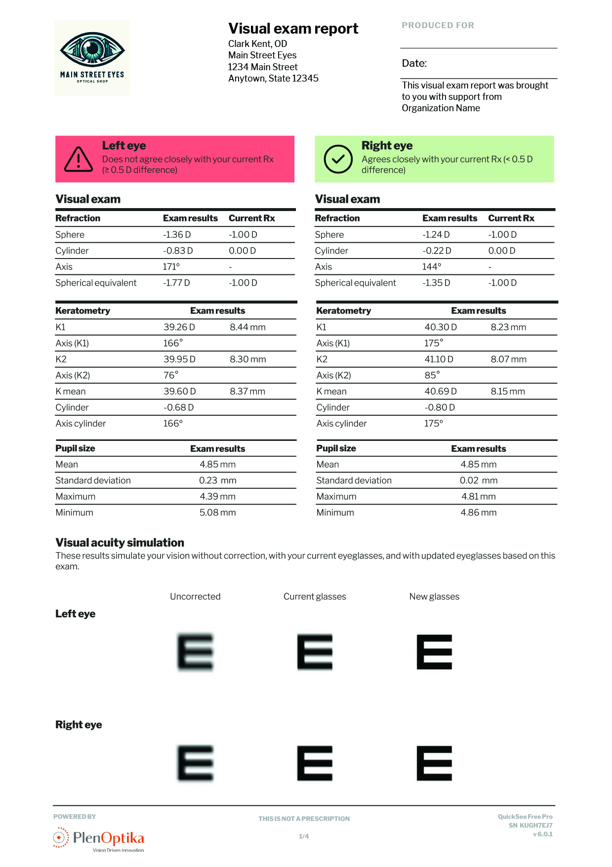 Handheld autorefraction and keratometry | QuickSee Free Pro Handheld ...